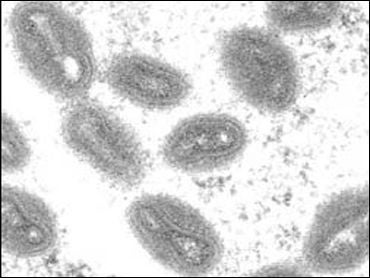 The Smallpox Threat: How Serious? - CBS News