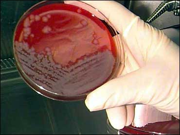 Anthrax Found In Connecticut - CBS News