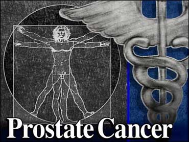 Study Compares Prostate Cancer Treatments - CBS News