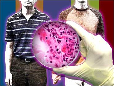 Resistant Strain Of Syphilis Found - CBS News