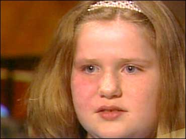 Living With A Birthmark - CBS News