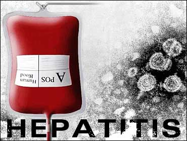 Hepatitis C: Progress Toward Vaccine? - CBS News