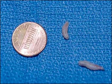 Docs Use Maggots To Treat Wounds - CBS News