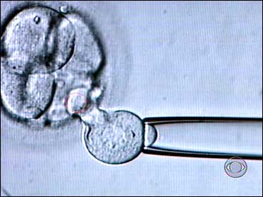 New Embryonic Test Raises Concerns - CBS News