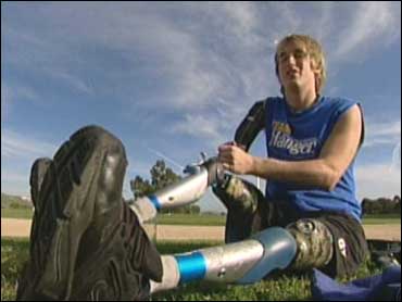 A Real Bionic Man - CBS News