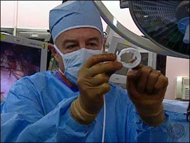 Diabetics Obesity Surgery: Stomach Stapling for the Not-So-Fat? - CBS News