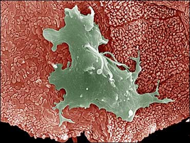 Scientists Study Parasitic STD - CBS News