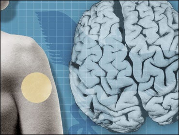 FDA Approves Skin Patch For Alzheimer's - CBS News
