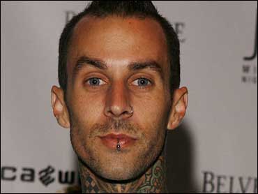Travis Barker Released From Burn Hospital - CBS News