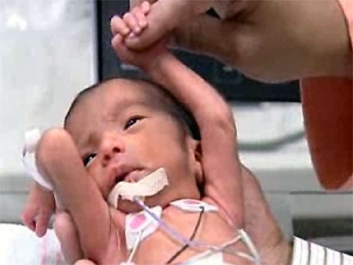 Houston Quintuplets (PICTURE) Answer Prayers for Infertile Couple - CBS ...