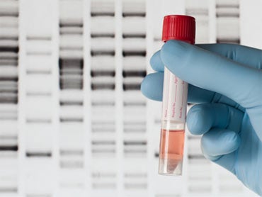 Scientists Grow Mini Liver with Human Cells - CBS News