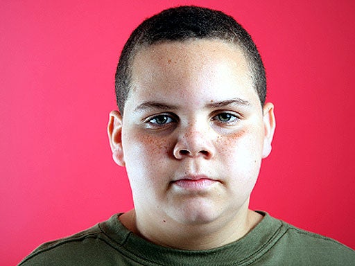 Overweight kids risk high blood pressure - CBS News