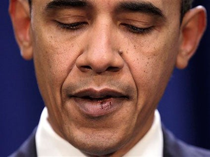 Obama Gets His Stitches Out - CBS News