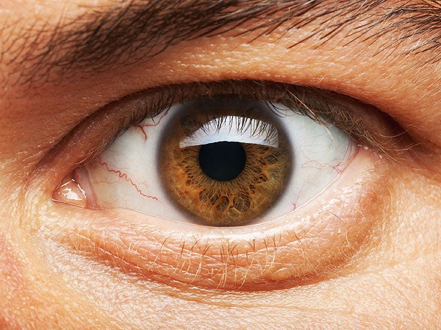 Macular Degeneration: Will Discovery Bring Cure for Blindness? - CBS News