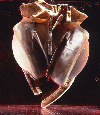 Plastic Heart: Smithsonian Honors First-Ever Artificial Heart - CBS News