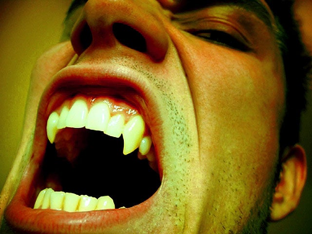 "Vampire Lawsuit": Sink your teeth into this one... - CBS News