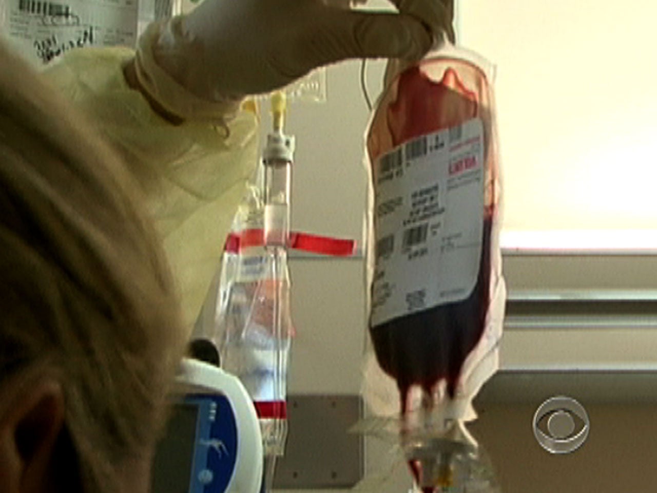 New cancer treatment reprograms immune system - CBS News