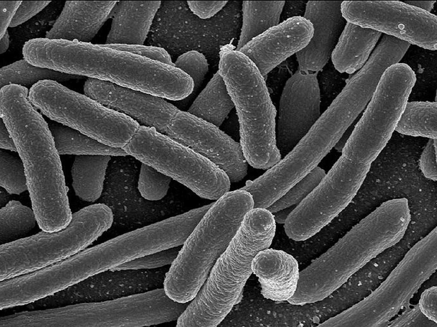 Suicide bacteria engineered to kill other bacteria - CBS News