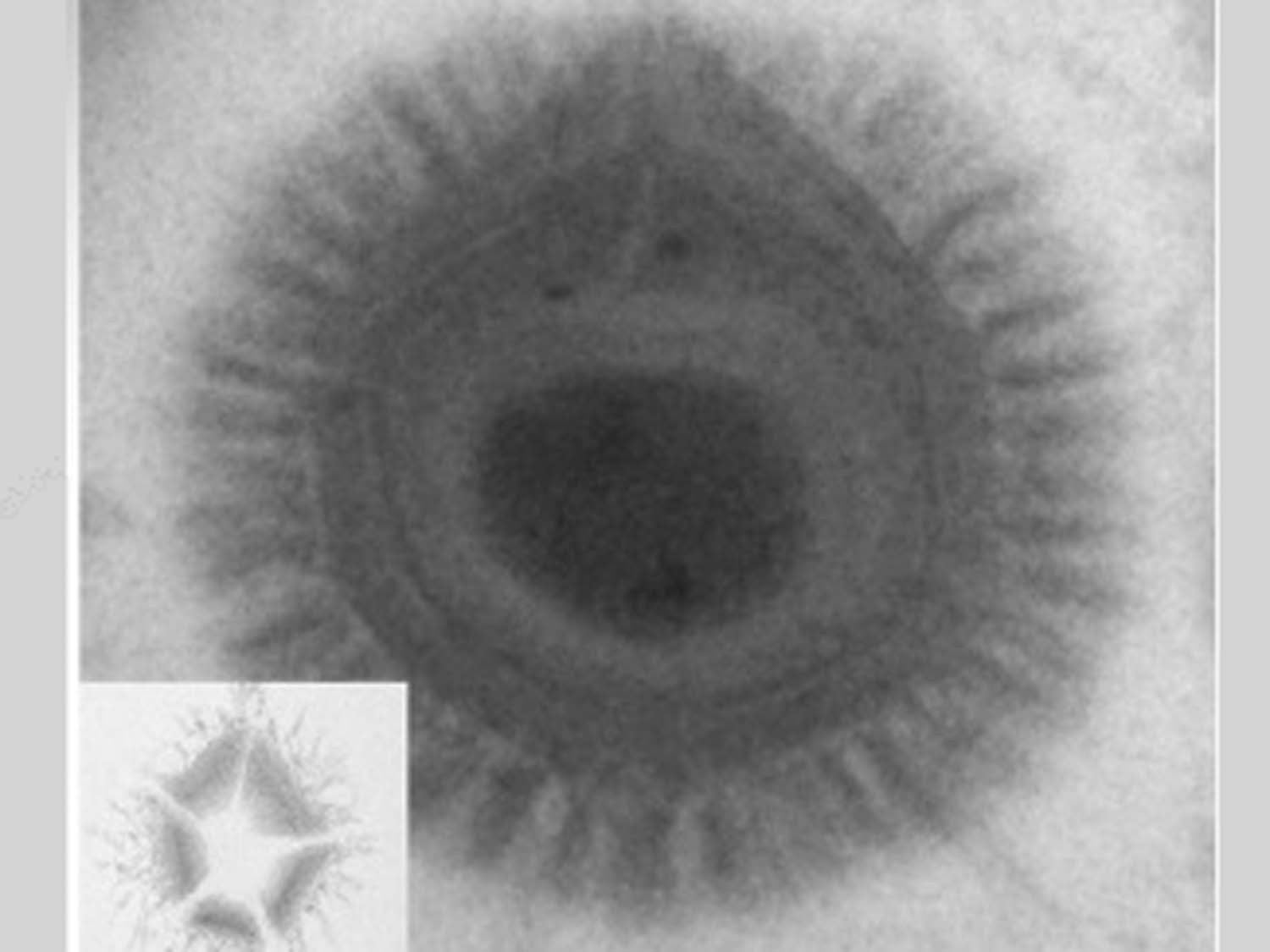 Gigantic virus discovery rivets scientists - CBS News
