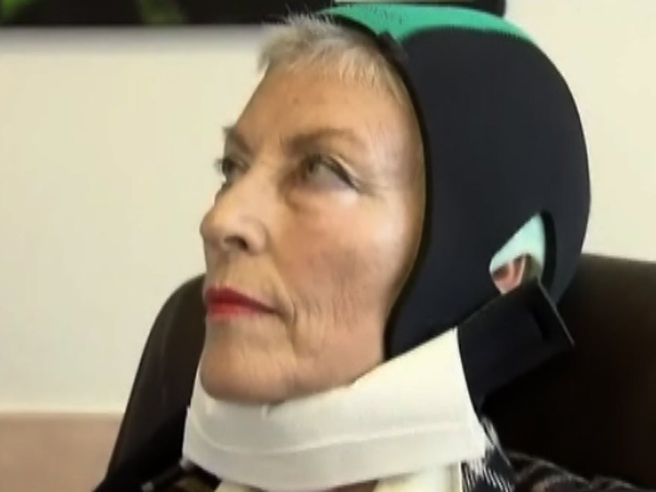 Chemotherapy without hair loss? Cooling cap in works - CBS News