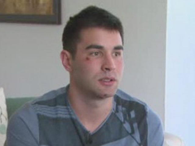 Gay Illinois State student claims attack was a hate crime - CBS News