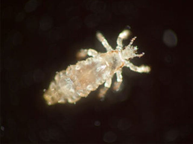 Lice genes reveal human migration - CBS News