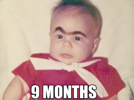 Are people with unibrows discriminated against? - CBS News