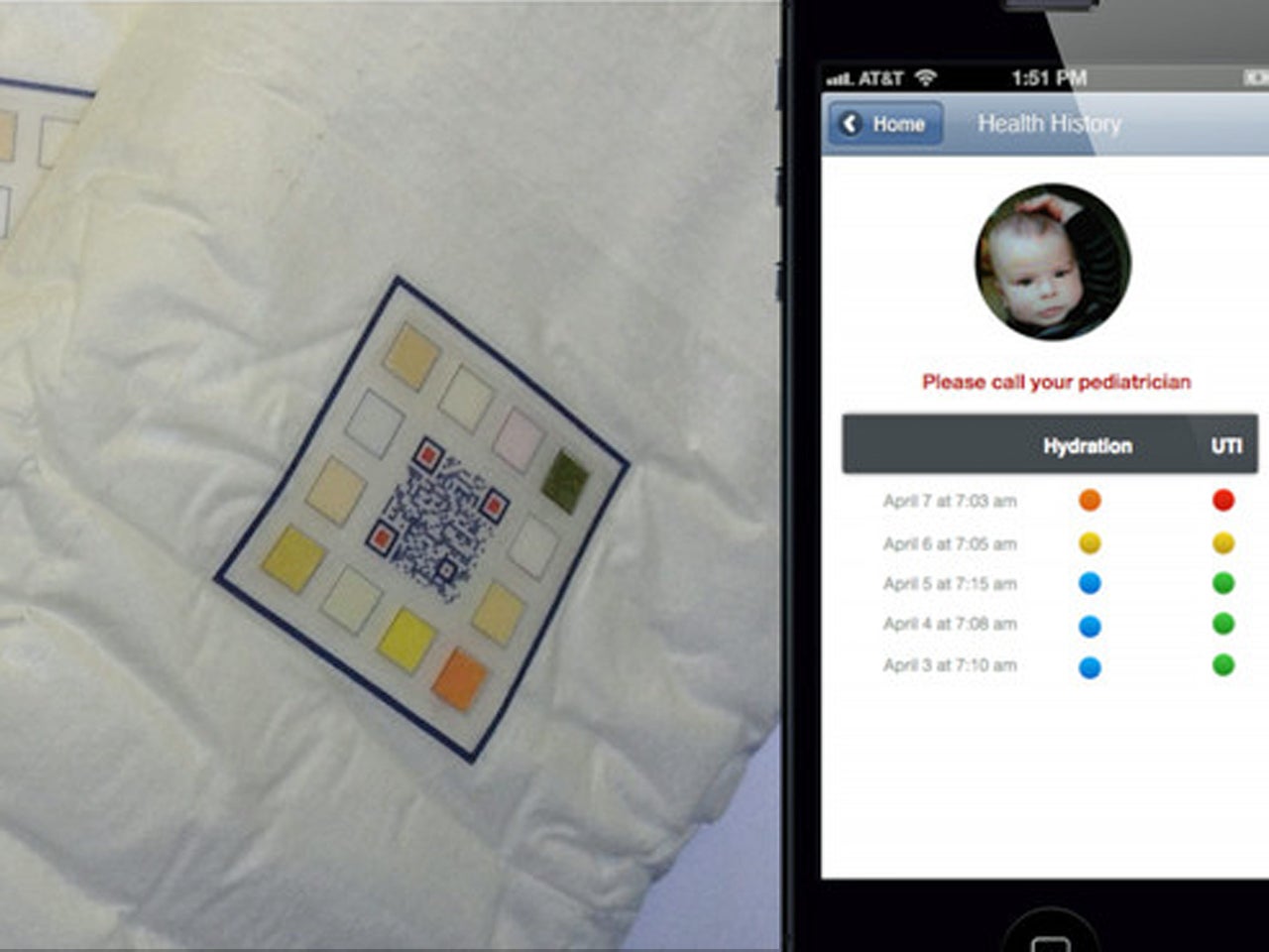"Smart Diaper" with QR code may track tots' urinary health - CBS News