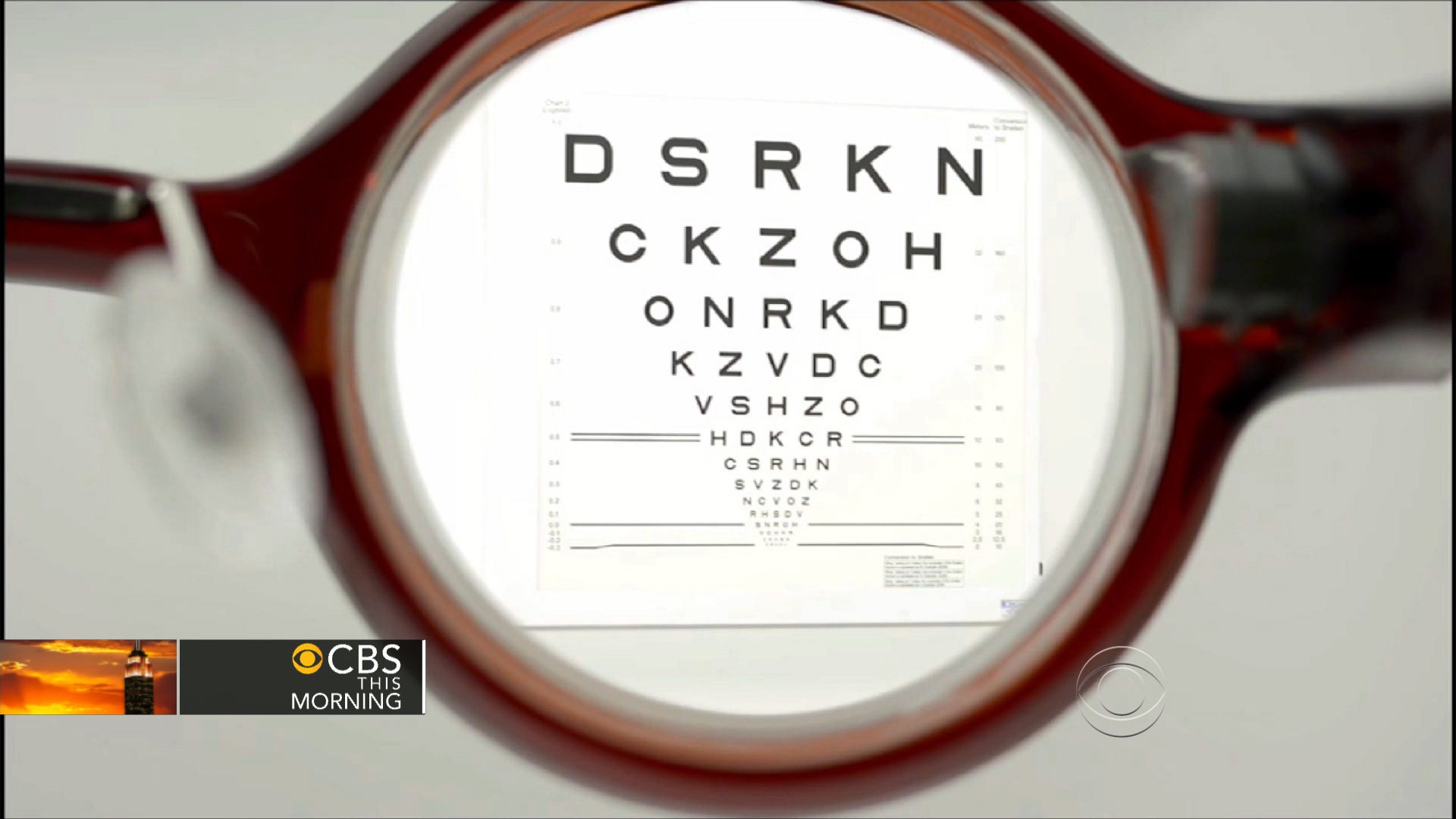 High-tech specs cut out need for doctor's visit - CBS News