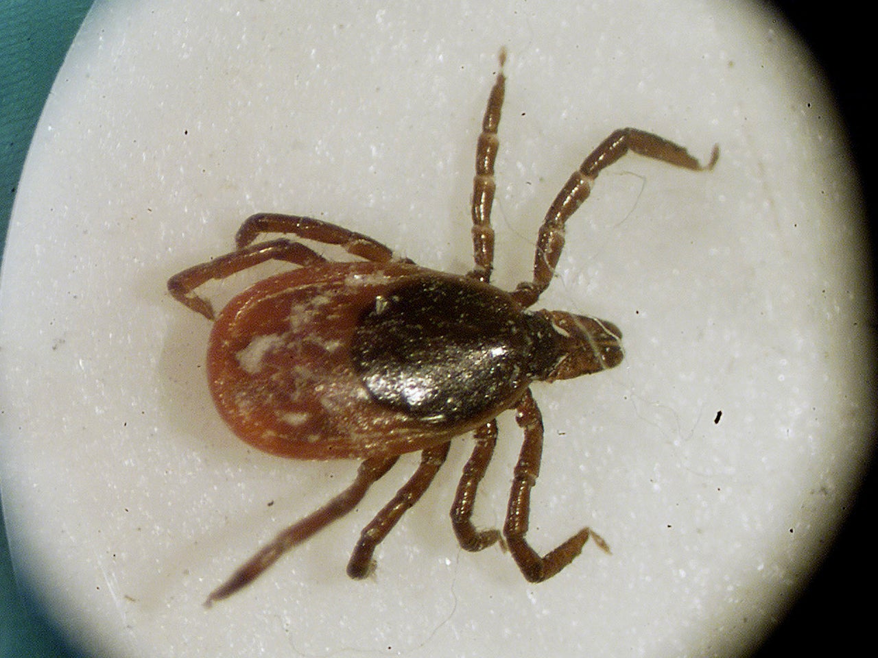 Rare (non-Lyme) infection caused by bacteria found in deer ticks - CBS News