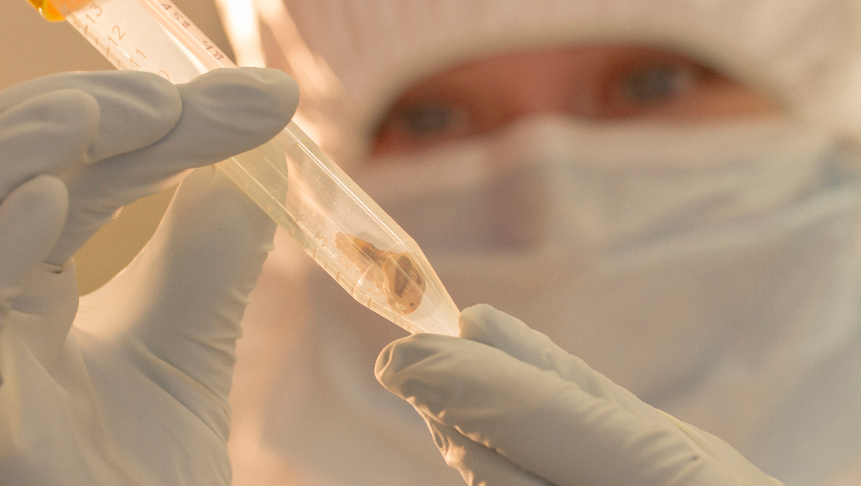 Same pathogen caused 2 of history's deadliest pandemics - CBS News