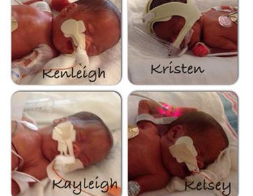 Surprise! Mom delivering triplets learns she's having quadruplets - CBS ...