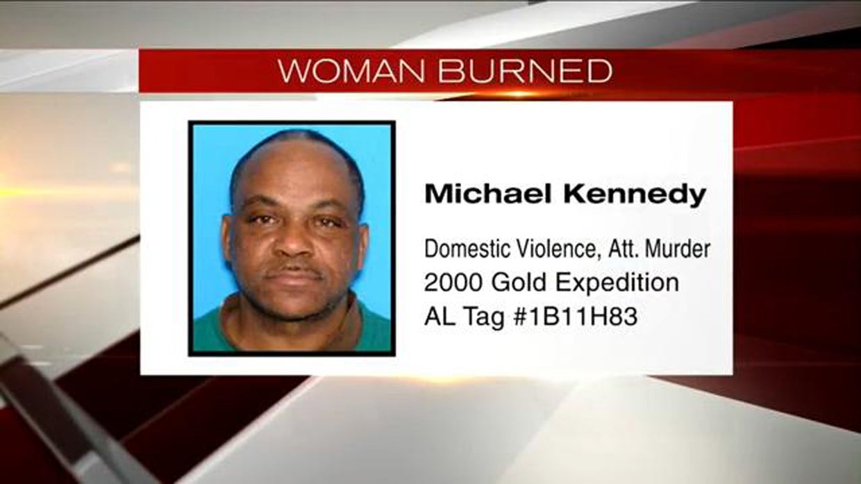 Michael Kennedy, Alabama man, accused of setting ex-girlfriend on fire ...