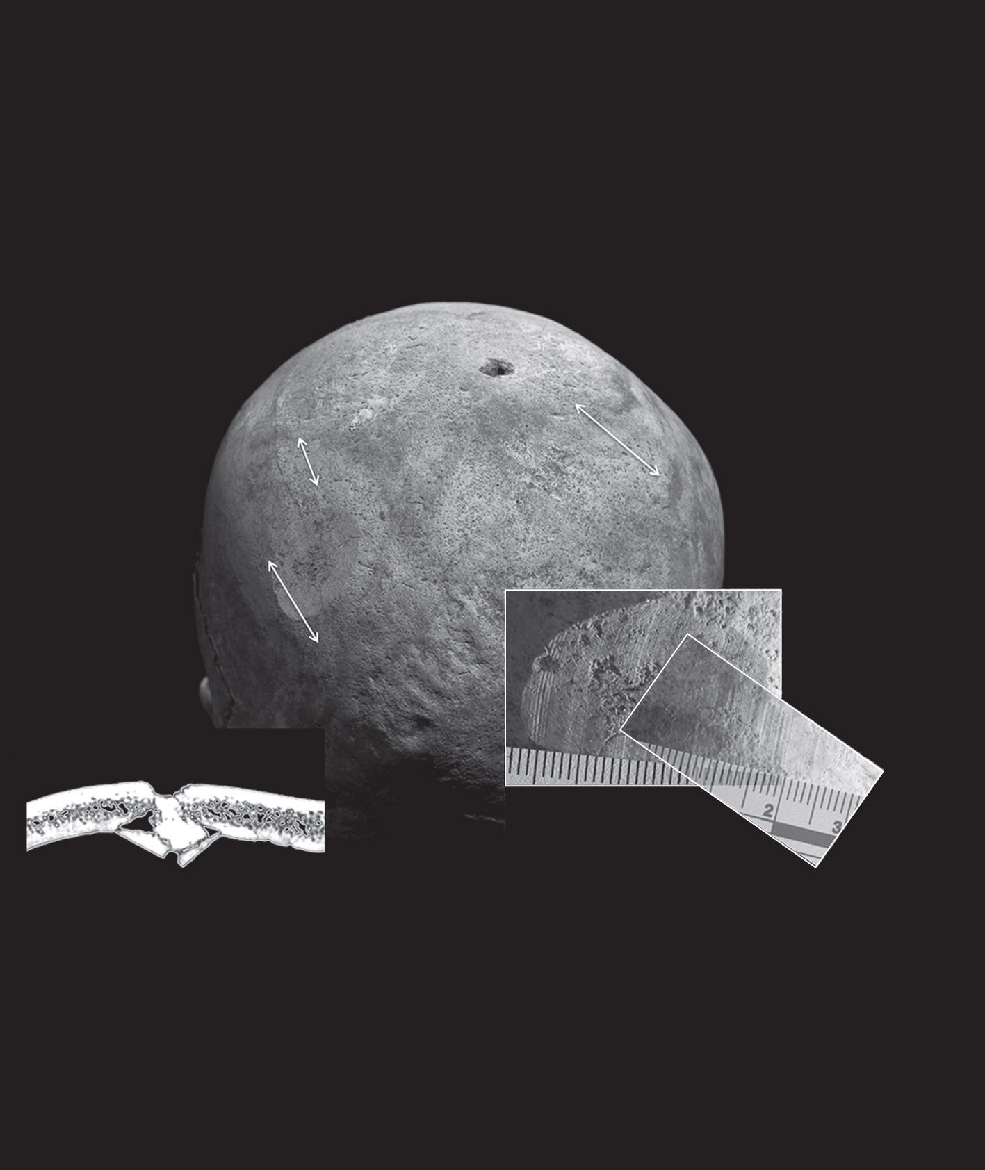 Forensic science solves mystery of Richard III's death - CBS News