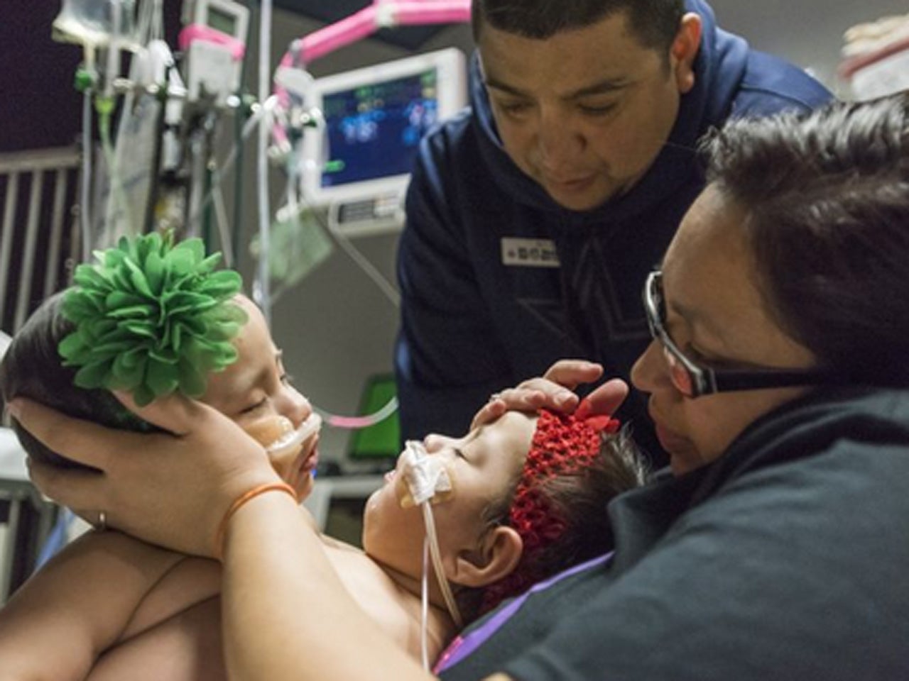 Conjoined Texas twins separated in 26-hour operation - CBS News