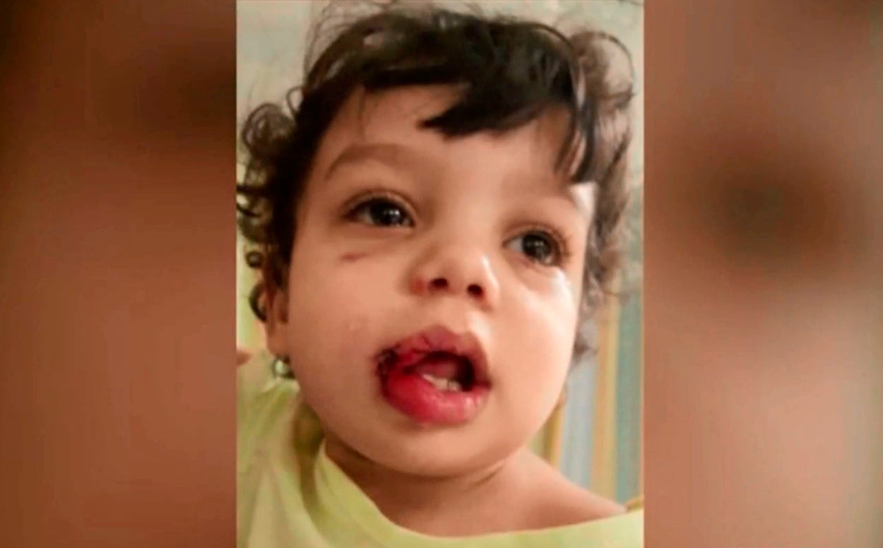 Family demands justice after toddler shot in face in New Jersey - CBS News