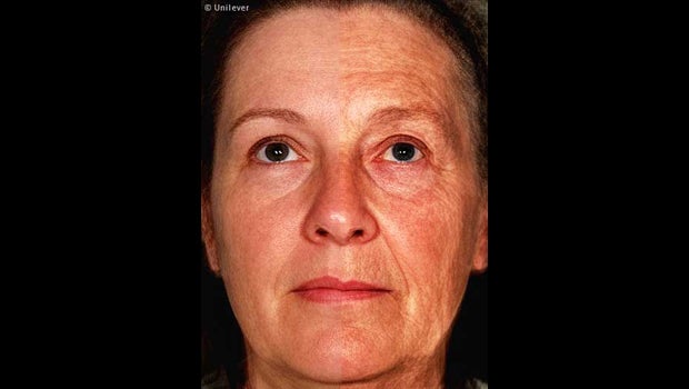 This gene may help determine how old you look - CBS News