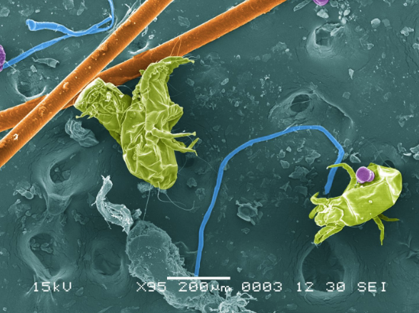 DNA in dust reveals truth about bugs lurking in our homes - CBS News