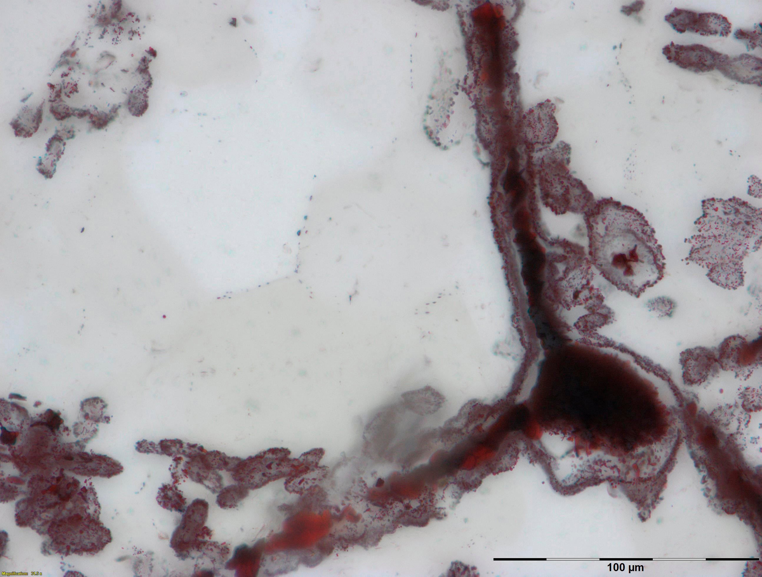 Tiny tubes, filaments in Canadian rock appear to be oldest known ...