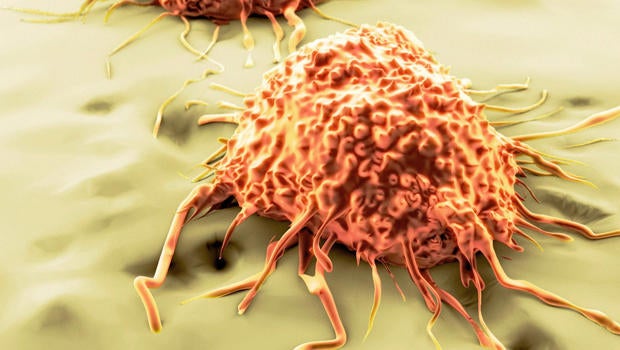 The history of cancer - CBS News
