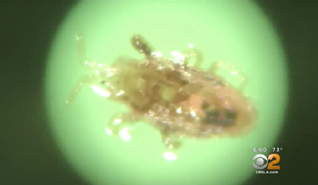 Rat infestation spreads at Calif. elementary school - CBS News