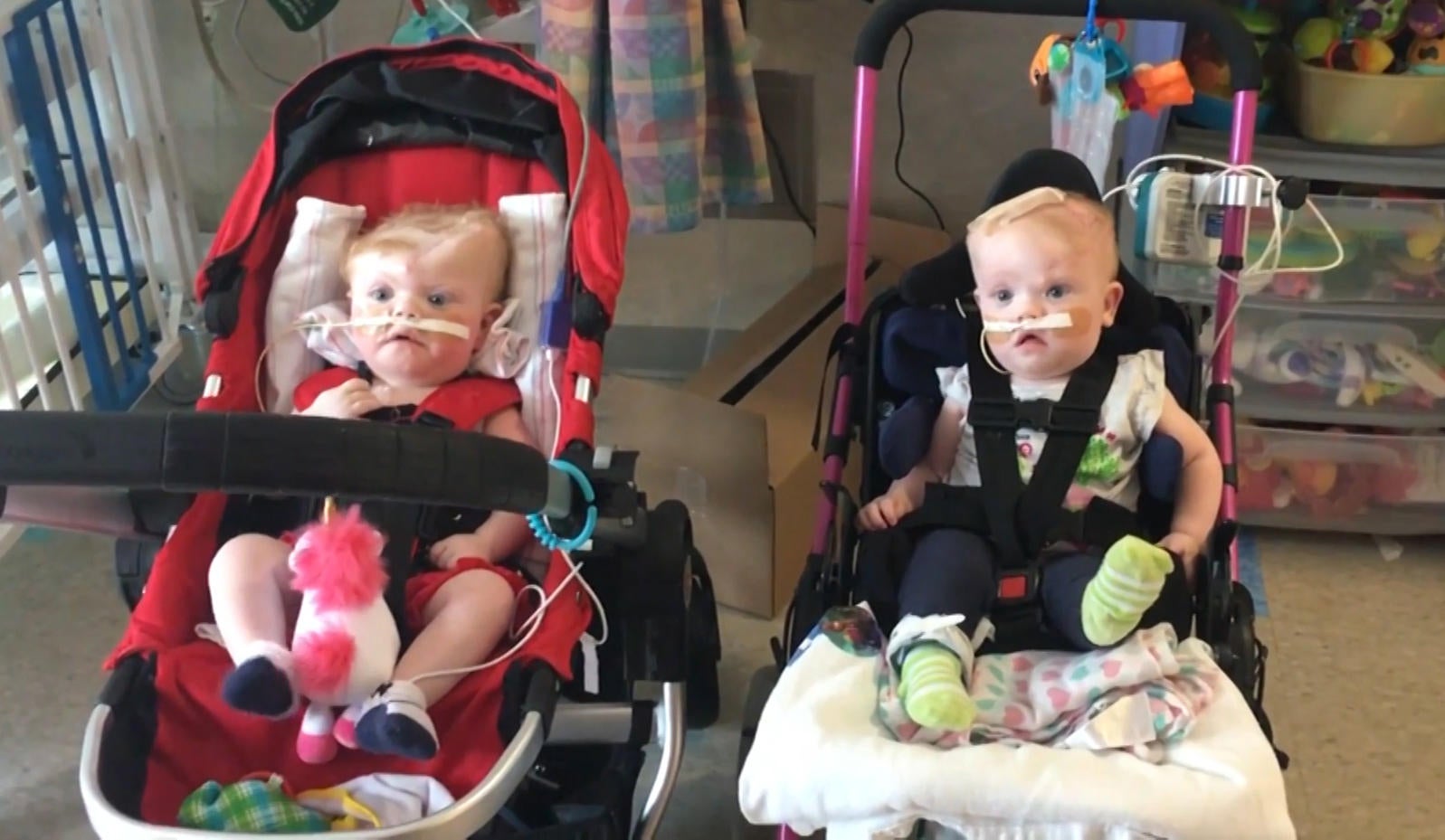 Recently separated conjoined twins getting ready to go home - CBS News