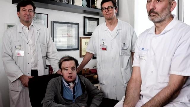 In a medical first, man gets 2nd face transplant - CBS News