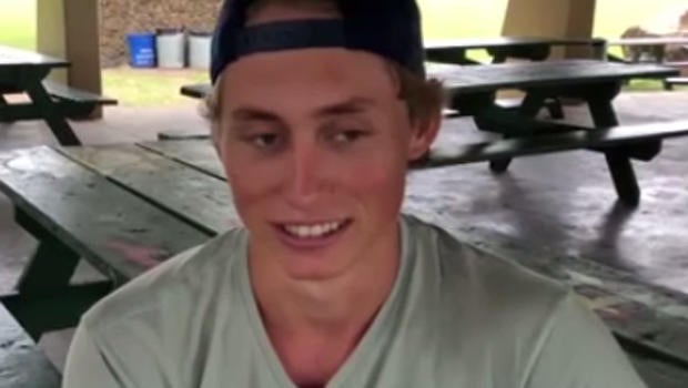 Dylan McWilliams, who survived what he says was bear attack, is bitten ...