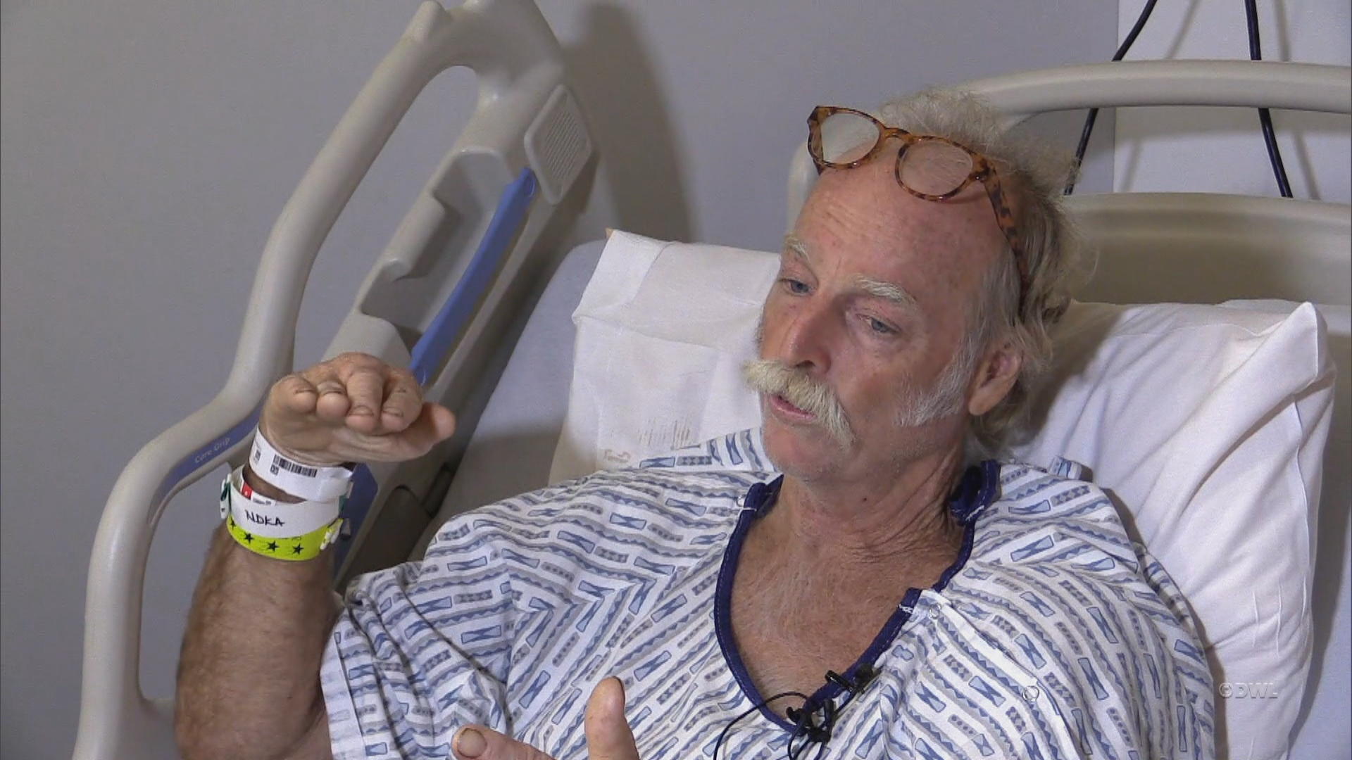 Man says lava bomb from Hawaii volcano "snapped" his leg in half - CBS News