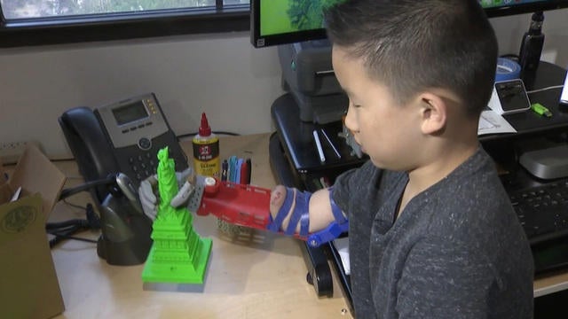 Boy missing part of his arm gets 3-D printed "upgrade" - CBS News