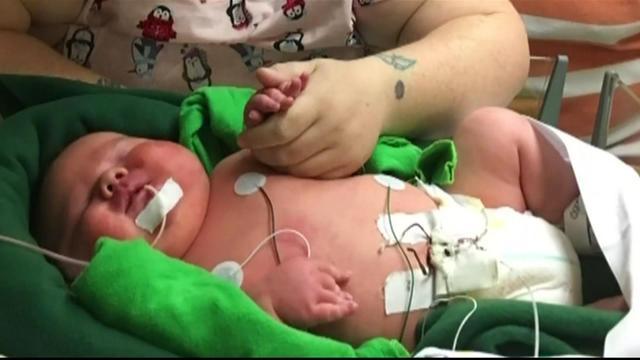 Baby weighing nearly 15 pounds at birth breaks Texas hospital records ...