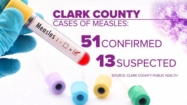 Washington state weighs vaccination bill as measles outbreak spreads ...