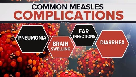 Measles vaccine: Adults who were vaccinated in the 1960s may need a ...