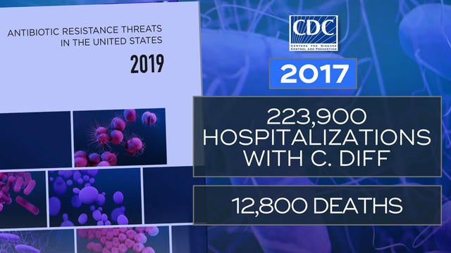 CDC identifies new superbugs that are potentially deadly - CBS News